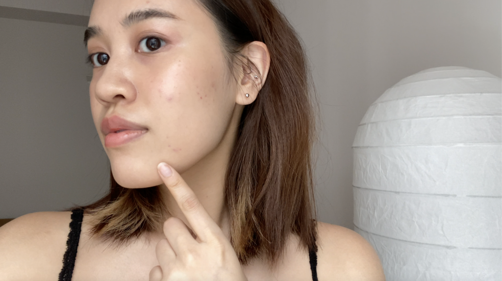 How to Treat and Prevent Maskne (Mask Acne) - Glow Recipe