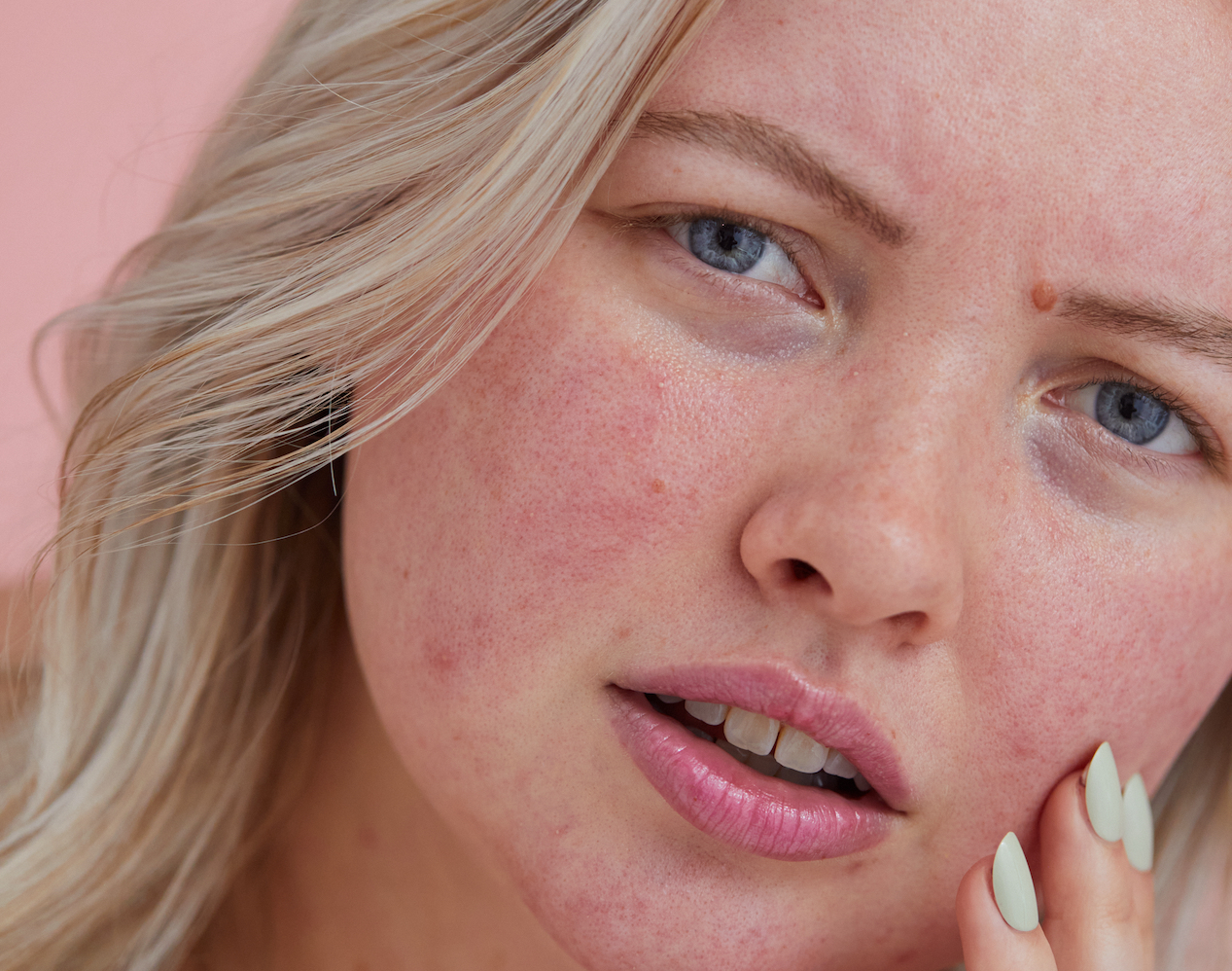 A Dermatologist Breaks Down 4 Tiktok Skincare Trends Glow Recipe