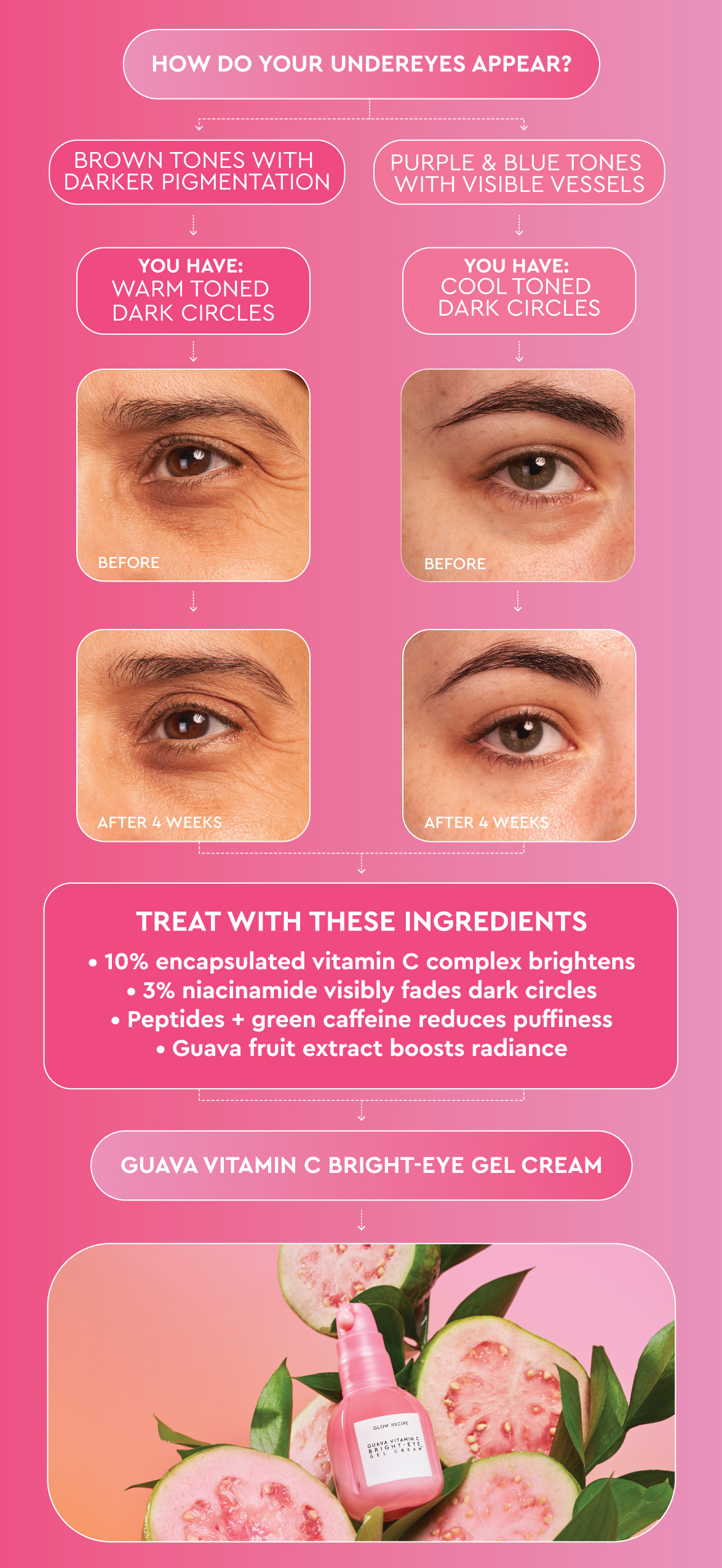 The 3 Types Of Dark Circles How To Treat Them Glow Recipe